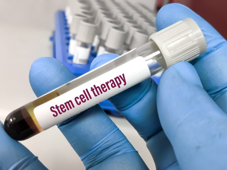 Leyla Weighs In: Innovations in Stem Cell Therapy–A Mitochondrial ...