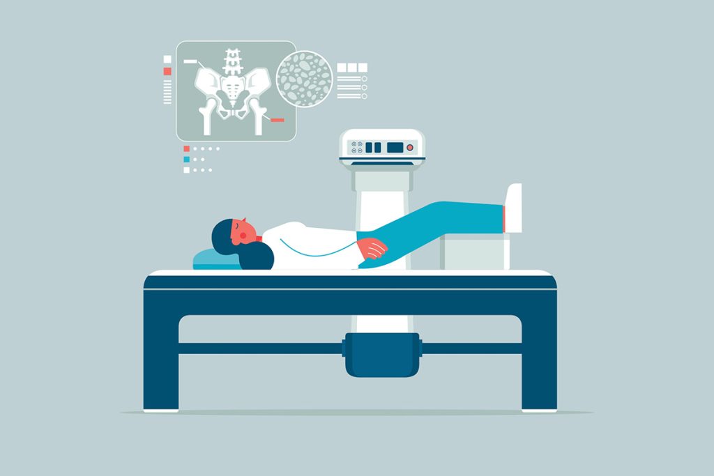 The osteoporosis conveyor belt: From bone density screening to drugs ...